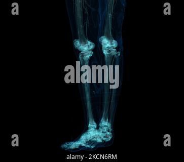 3D render of lower extremity or legs isolated on black background Stock ...