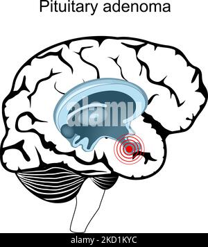 Brain hypothalamus and pituitary gland vector illustration Stock Vector ...