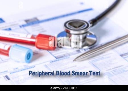 Peripheral Blood Smear Test Medical check up test tube with biological ...
