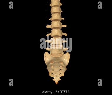 CT scan of Lumbar spine 3D rendering showing Profile Human Spine ...