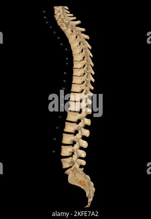 CT scan of Lumbar spine 3D rendering showing Profile Human Spine ...