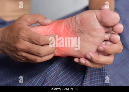 Itchy foot skin of Asian young man. Concept of skin diseases such as ...