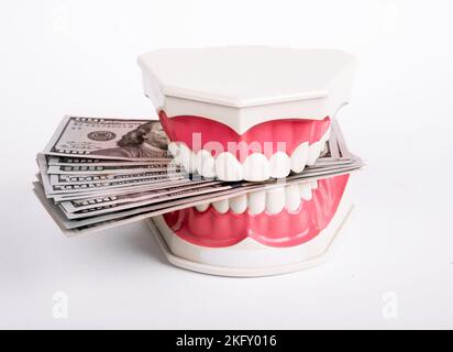 Expensive dentistry concept. Dentist with dollars money for teeth ...