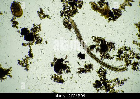 human parasites in the human gut health Stock Photo - Alamy
