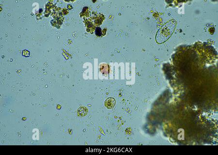 human parasites in the human gut health Stock Photo - Alamy