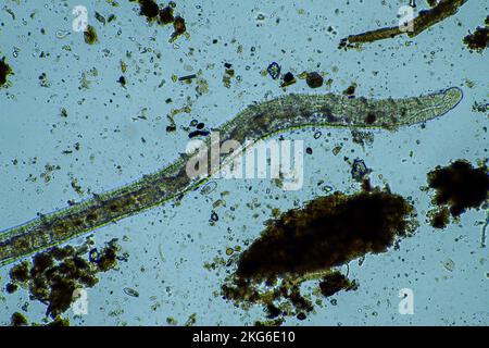 human parasites in the human gut health Stock Photo - Alamy