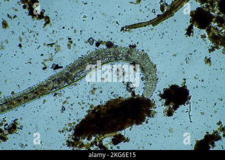 human parasites in the human gut health Stock Photo - Alamy