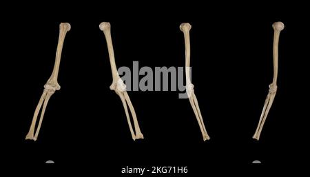 Bones of Forearm-Multiple Views Stock Photo - Alamy