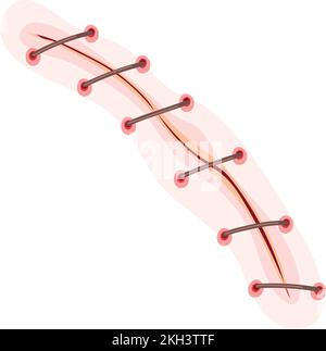 Stitched wound. Lacerated skin cut. Bloody scar isolated on white background Stock Vector Image ...