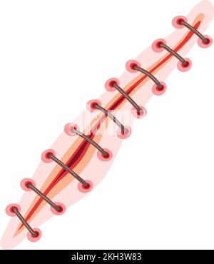 Skin incision wound. Bloody surgery stitch scar or cut on body ...