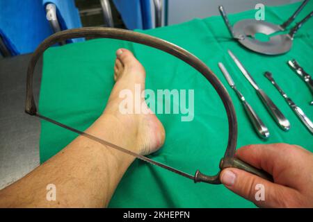 an amputation saw is applied to one leg in an operating room Stock ...