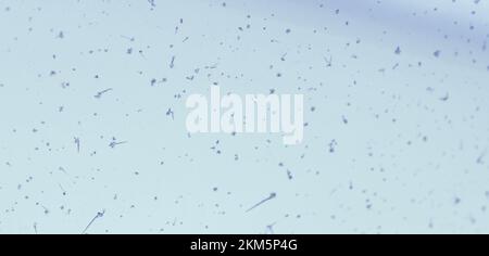 Small ice crystals form on the airplane window Stock Photo - Alamy