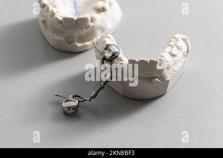 Plaster models of dental prostheses. Demonstration models of dentures ...