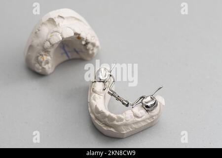 Plaster cast of teeth and dentures, which is made in this mold isolated ...