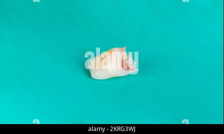 Children's milk tooth on a green background, macro. Pediatric dentistry ...