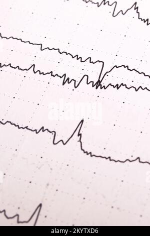 Electroencephalogram graph on a white paper close up Stock Photo - Alamy