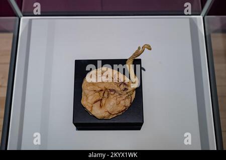 Bari, Italy. 02nd Dec, 2022. Detail of two human bodies embraced at the ...