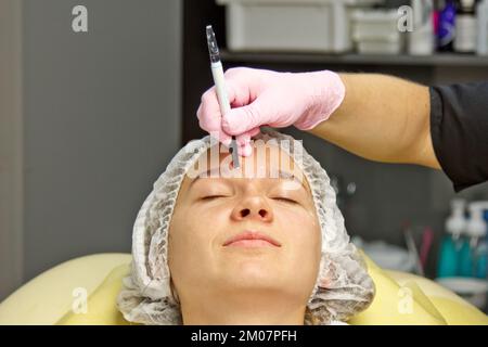 Blepharoplasty, plastic surgery operation for correcting defects ...