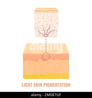 Olive skin tone pigmentation mechanism medical diagram Stock Vector ...