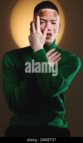 Vitiligo, man face and fashion model portrait for luxury beauty, style ...