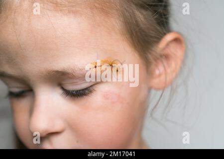 Close up sad, brave, drear cropped girl face with stitches on scratch ...