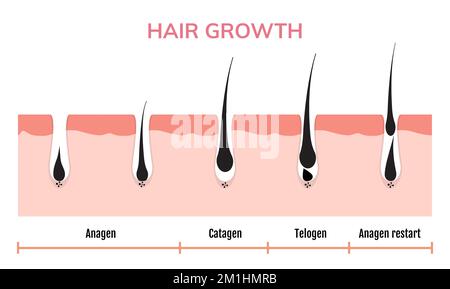 Hair growth cycle phases vector cross section infographics. Anagen ...