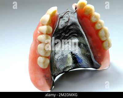 Dental prosthesis | Prothèse dentaire 13/03/2018 Stock Photo - Alamy