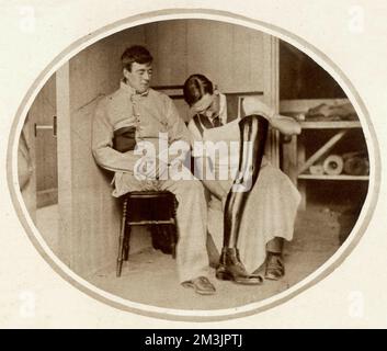 British WWI soldiers / leg amputees fitted with artificial limbs ...