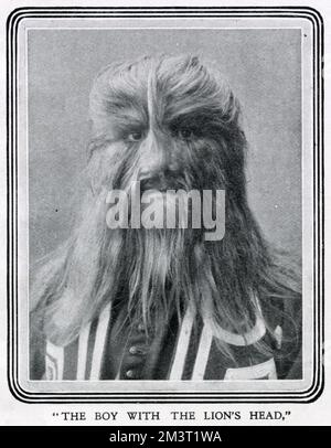 Stephan Bibrowski - Lionel the Lion-faced Man Stock Photo - Alamy