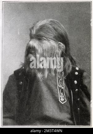 Lionel the Lion-faced Man Stock Photo - Alamy