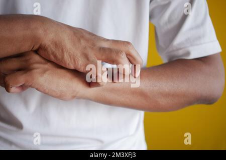 man suffering from itching skin, close up Stock Photo - Alamy