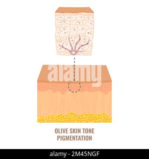 Light skin tone pigmentation mechanism medical diagram Stock Vector ...