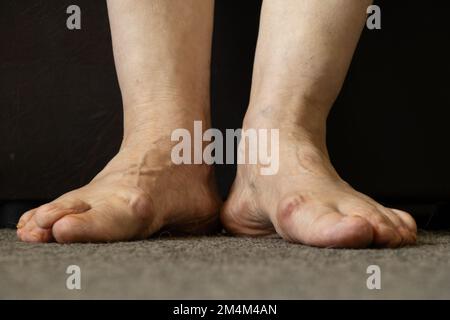 old grandmother's feet on the floor in her room close-up Stock Photo ...