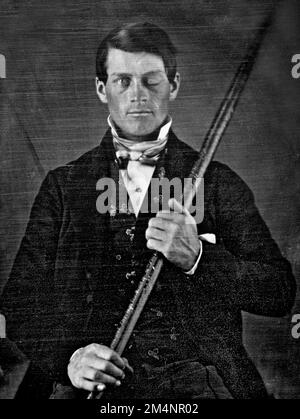 Phineas Gage, Phineas P. Gage (1823–1860) American railroad ...