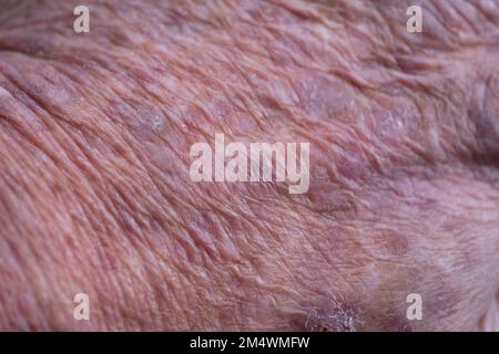 Red crusty lesions of actinic keratosis or sunspots on sun-damaged skin ...