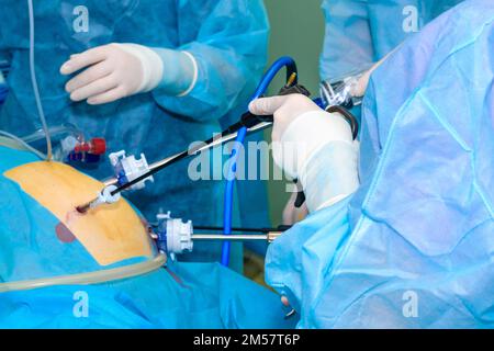 Laparoscopic surgical equipment during proctological minimally invasive ...