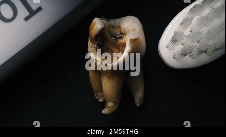 Tooth decay on black background. Macro shot of a decayed teeth till ...