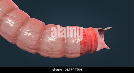 The small intestine consists of four main layers of tissue, which are ...
