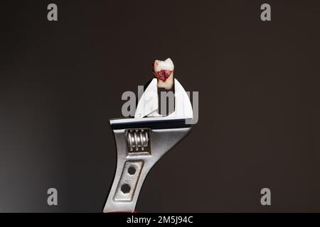 Tooth extraction with dental tools with caries by a professional ...