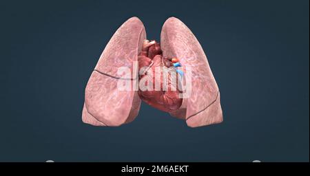Pulmonary embolism, illustration Stock Photo - Alamy