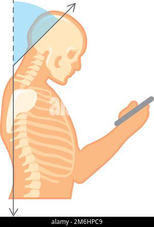 Phone using posture. Neck position, ergonomic infographic for people ...
