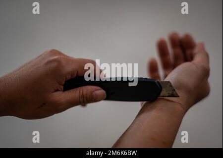 A depressed woman attempted suicide by cutting her wrist veins with a ...