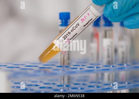 close-up of handling test tubes in a medical laboratory Stock Photo - Alamy