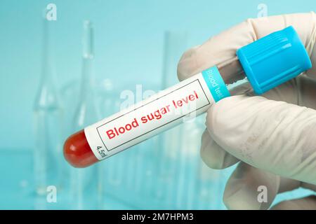 HbA1C Test Medical check up test tube with biological sample Stock ...