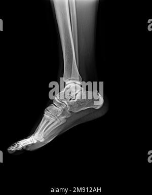 X-ray normal foot lateral Stock Photo - Alamy