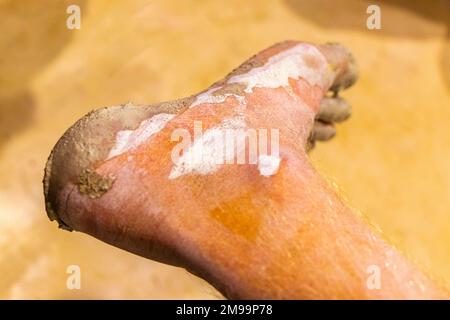 Extremely dirty white dusty mud feet on Isla Holbox island in Quintana ...