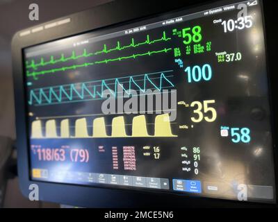 Hospital Monitors electrocardiogram pulse blood pressure anesthesia ...