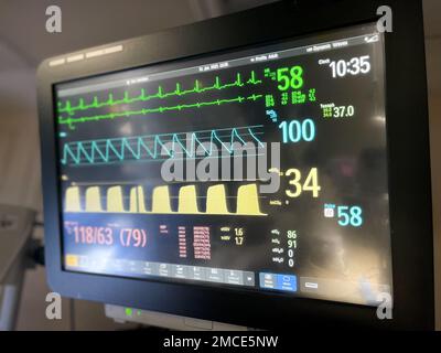 Hospital Monitors electrocardiogram pulse blood pressure anesthesia ...