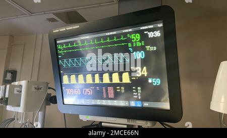 Hospital Monitors electrocardiogram pulse blood pressure anesthesia ...