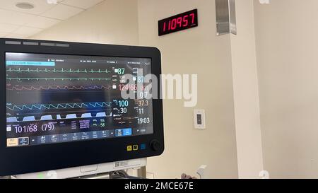 Hospital Monitors electrocardiogram pulse blood pressure anesthesia ...